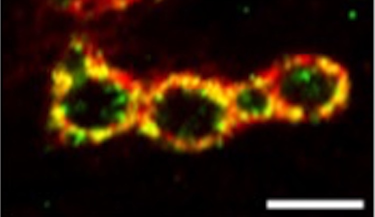 Van Vactor Lab uncovers a novel regulatory mechanism in synaptogenesis | Cell Biology